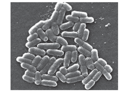 The photograph shows a magnified image of bacterial cells from a human ...